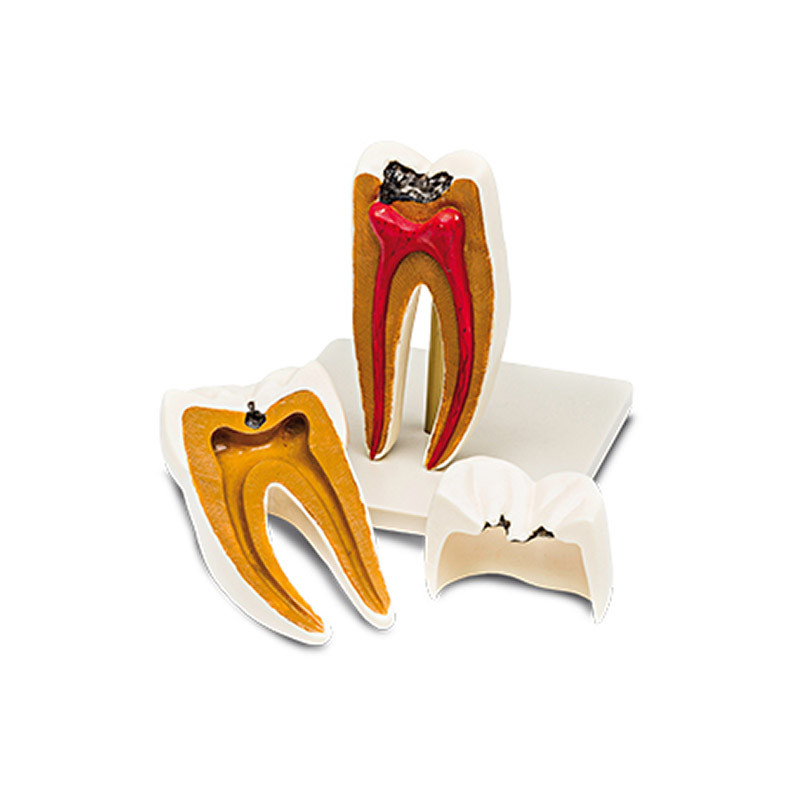 Enlarged model of molar tooth B23 - Dentaland